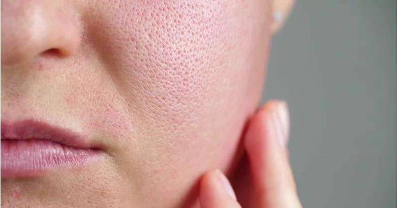 How To Fix Your Damaged Skin Barrier | Hudson Dermatology and Laser Surgery